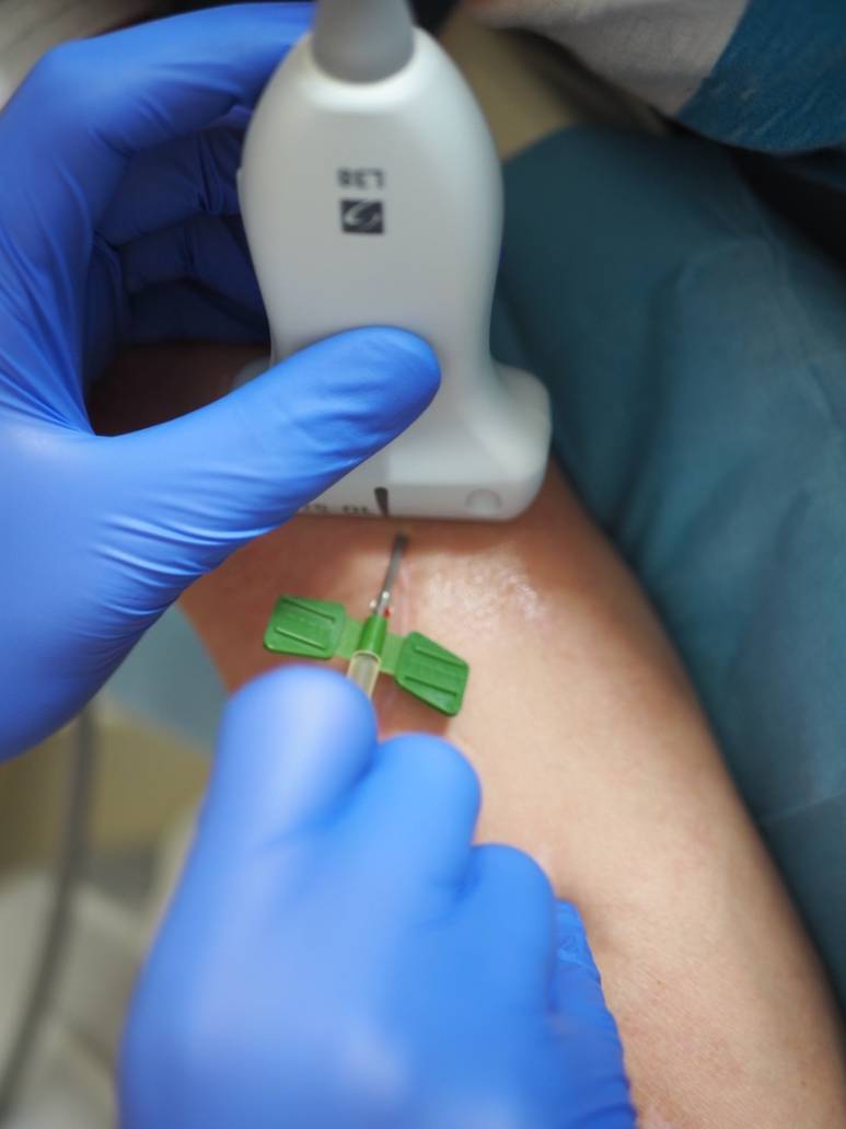 Dialyse Shunt-Seminar – Nephro-Xperts